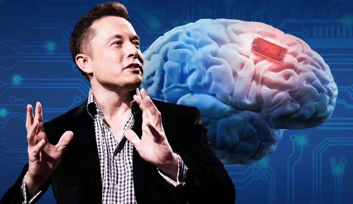 Se Implantó El Primer Neuralink En Un Humano Según Musk