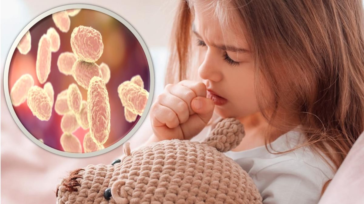 Confirman cuatro casos de tos ferina en Tabasco